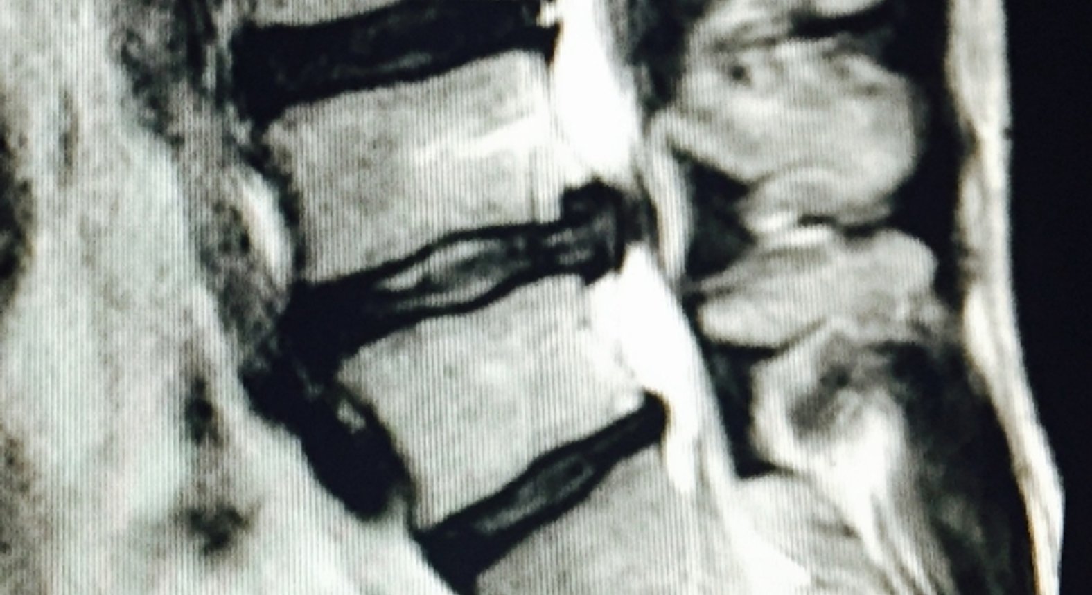 OA Dr. med. Nazem Atassi - Operationen bei degenerativen Erkrankungen ...