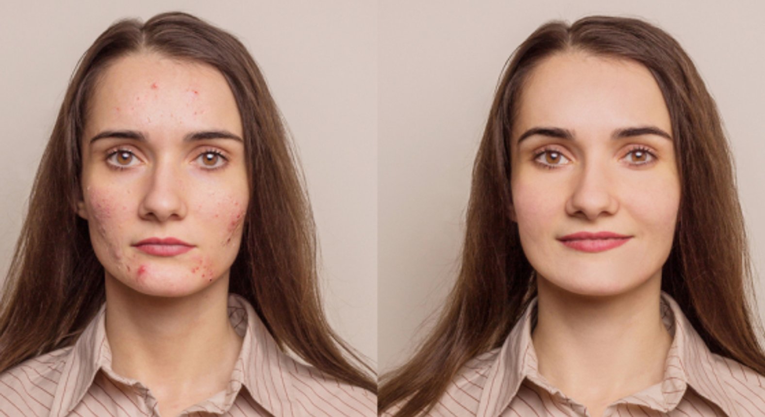 Dr. Ulrike Wieland - Narbenbehandlung | Hautärztin in 5020 Salzburg ...