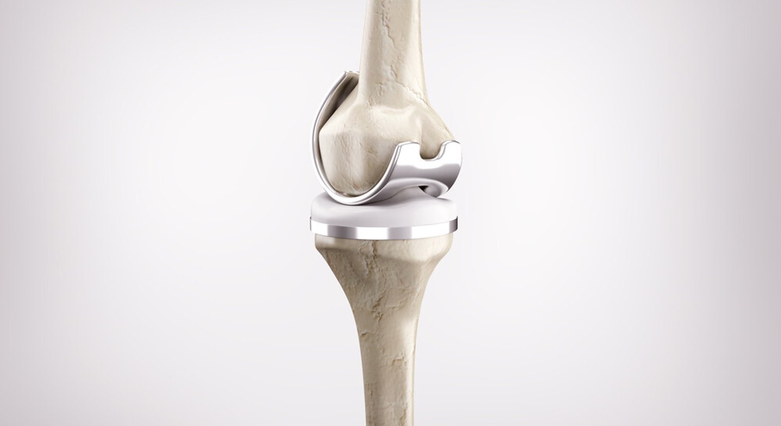 Dr. Robert Legenstein, MSc - Knieprothese | Orthopäde in 3400 ...
