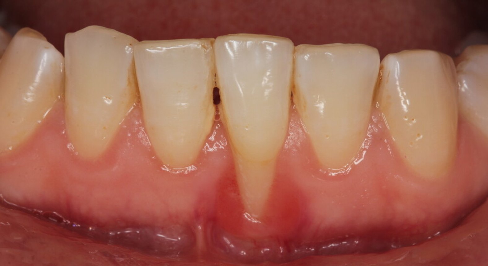 DDr. Andreas Pinter - Parodontaltherapie mit Ozon | Zahnarzt in 1180 ...