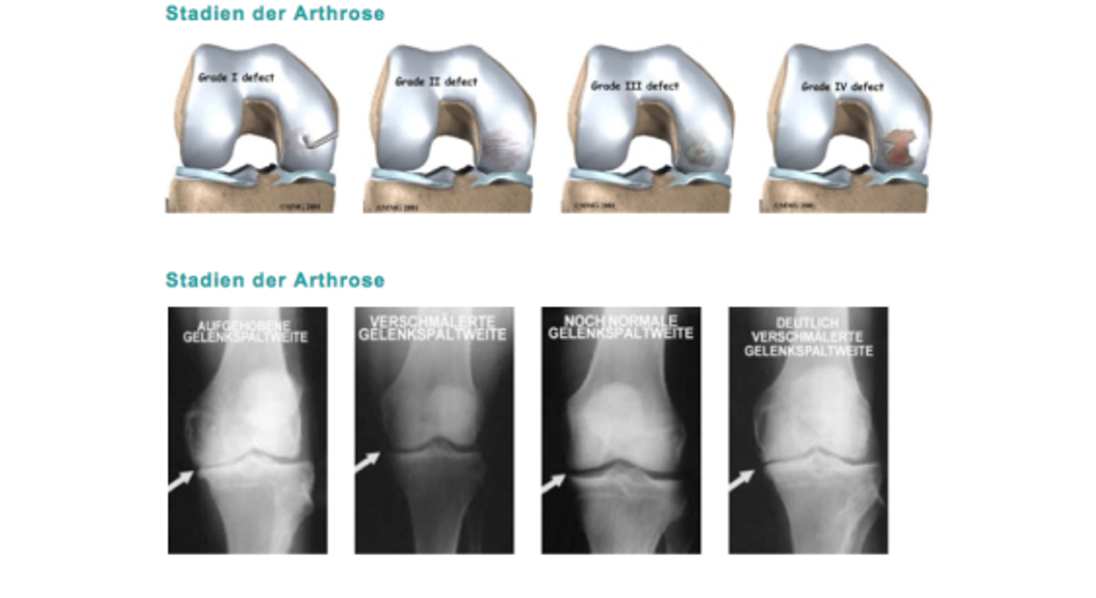 Dr. Hermann Leidolf - Arthrose | Unfallchirurg in 6020 Innsbruck ...